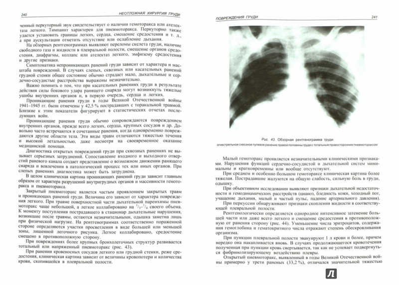 Неотложная хирургия груди и живота - Бисенков Леонид Николаевич ...
